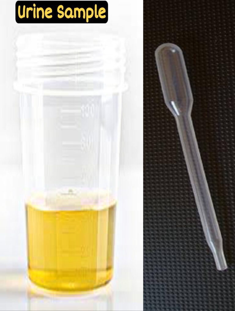 How To Check Pregnancy With Prega News Kit - Bright Cures